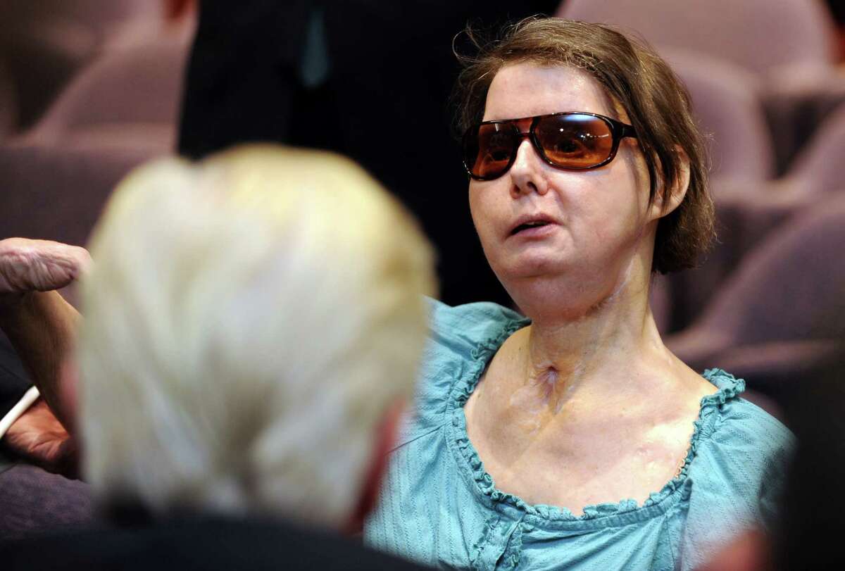 $4 million settlement in chimp attack lawsuit