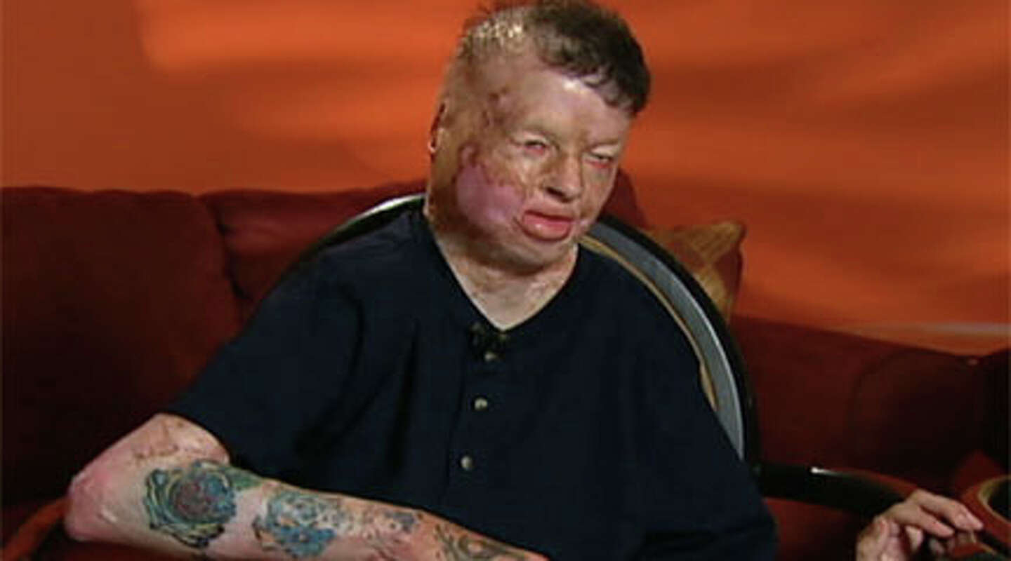 Killer in 'burned boy' case sentenced to 40 years in prison