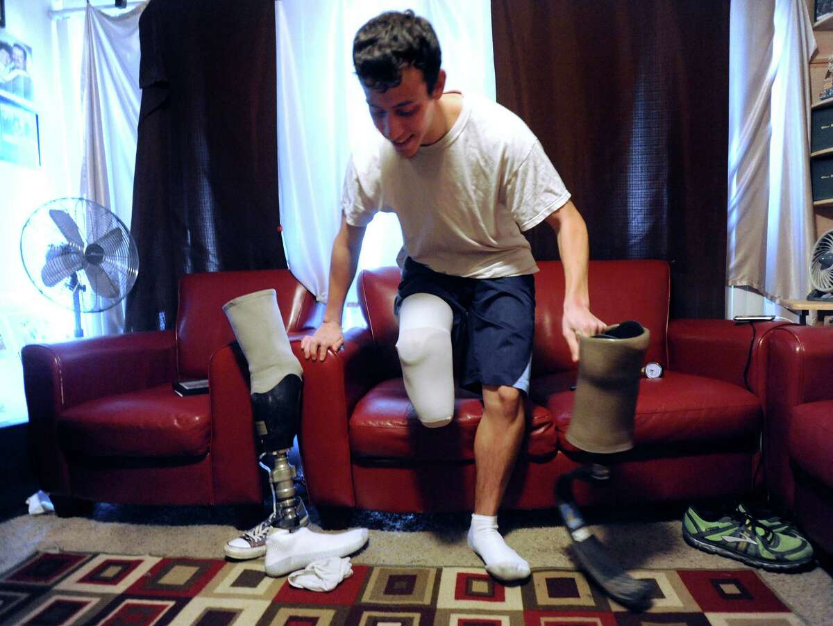 Amputee inspires audiences with story