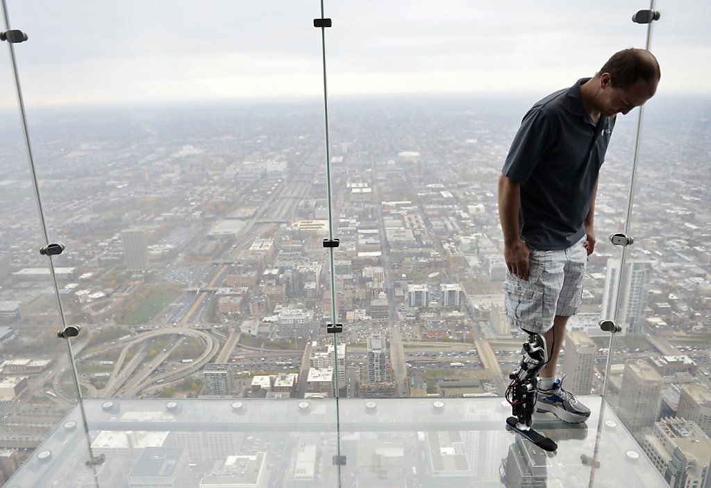 Man with thought-controlled bionic leg
