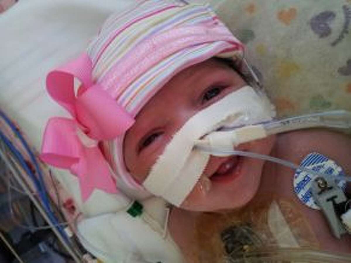 Baby born with heart outside her body is recovering after surgery