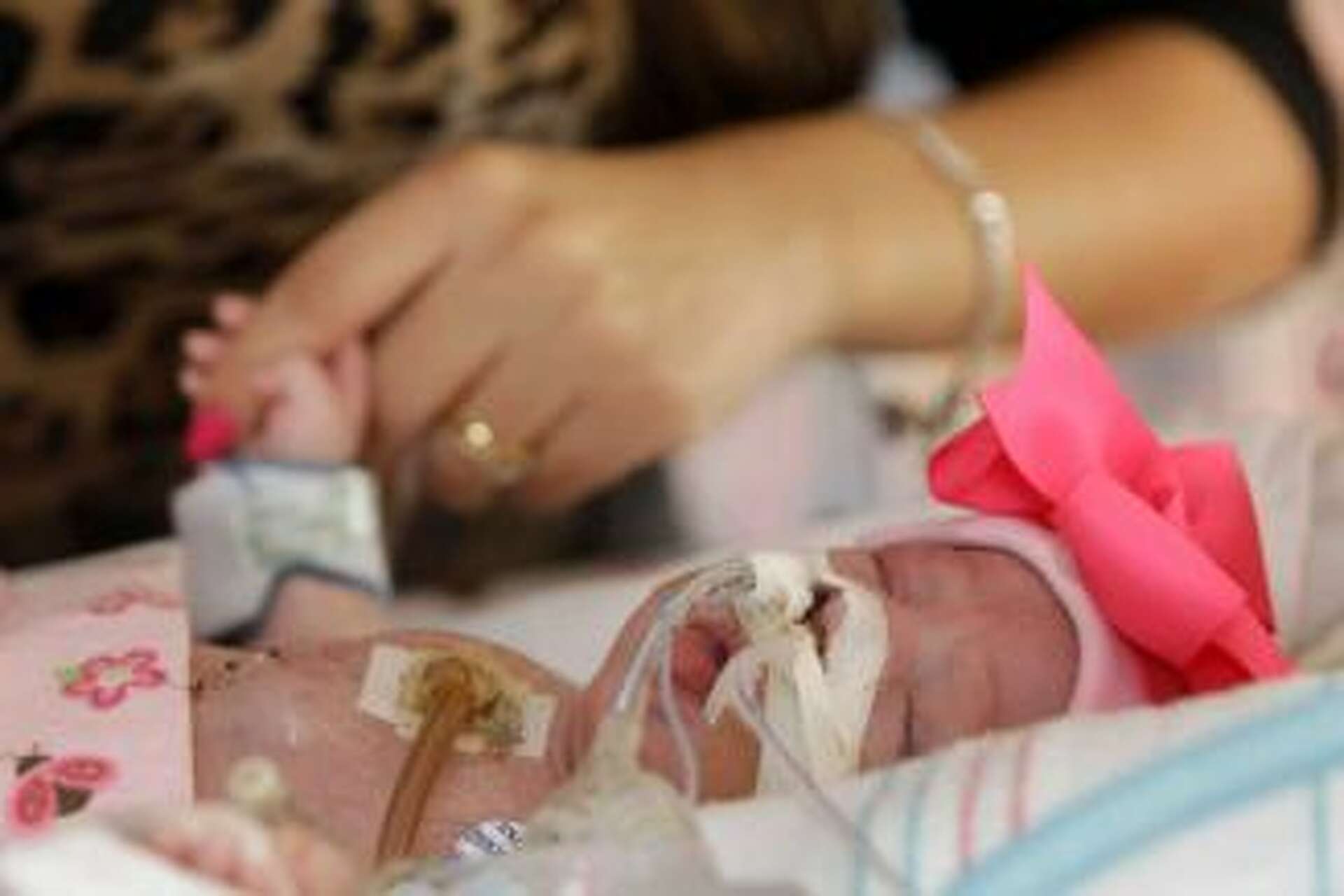 Baby born with heart outside her body is recovering after surgery