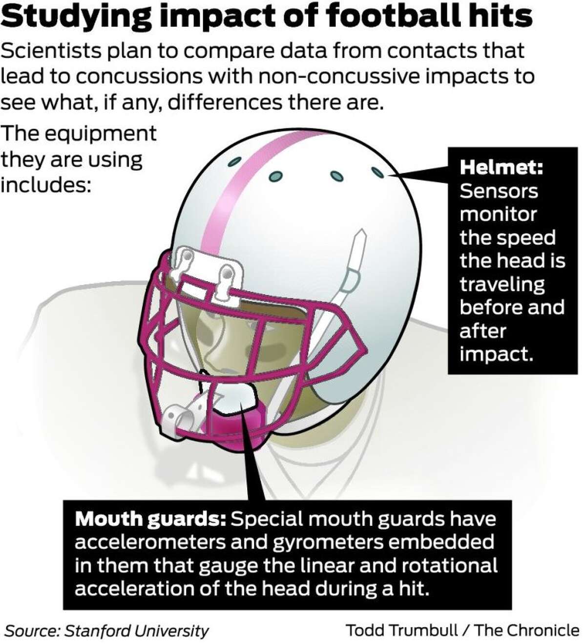 Stanford analyzes athletes' concussions