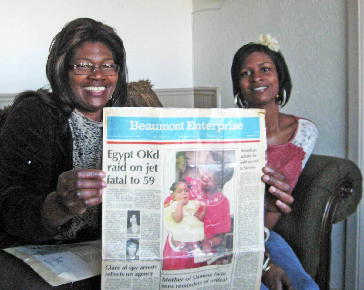 Siamese twin whose story amazed Beaumont now all grown up