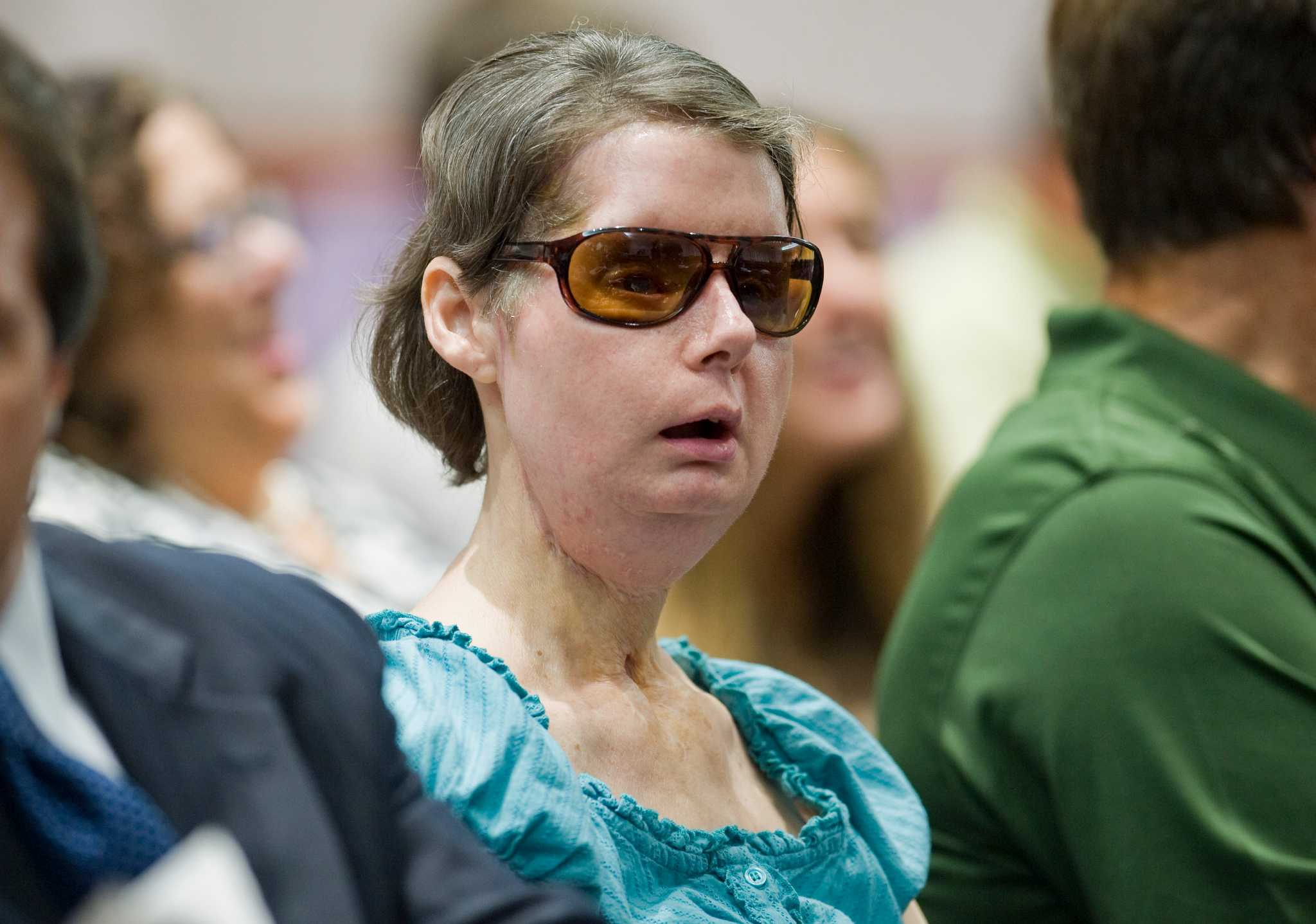 $4 million settlement reached in chimp attack