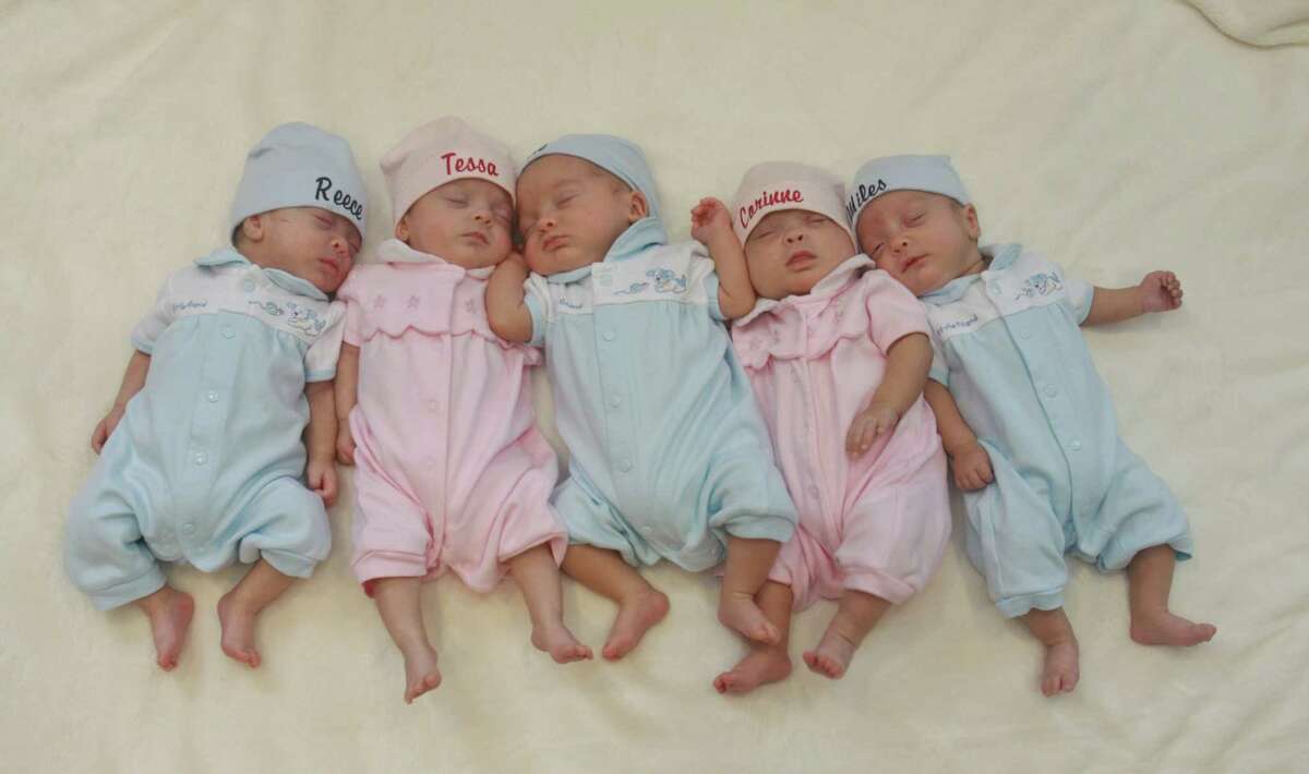 Best friends at birth: Rare set of twins born holding hands