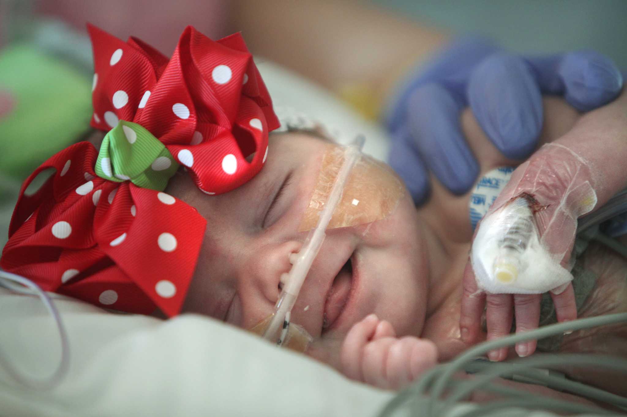 Baby With Rare Heart Defect To Leave Texas Children s Hospital baby-with-rare-heart-defect-to-leave-texas-children-s-hospital