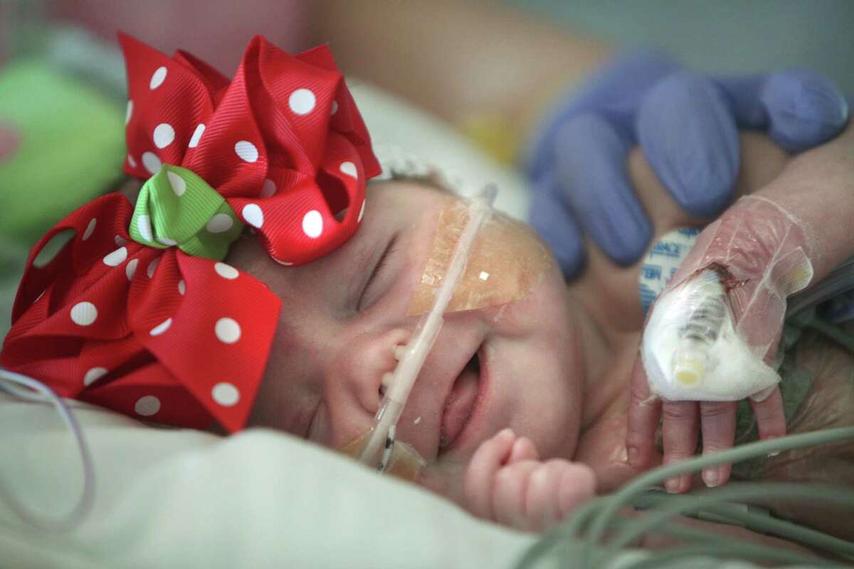 Baby born with heart outside her body goes home