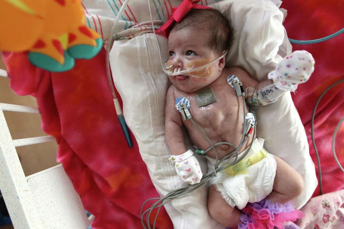 Baby born with heart outside her body goes home