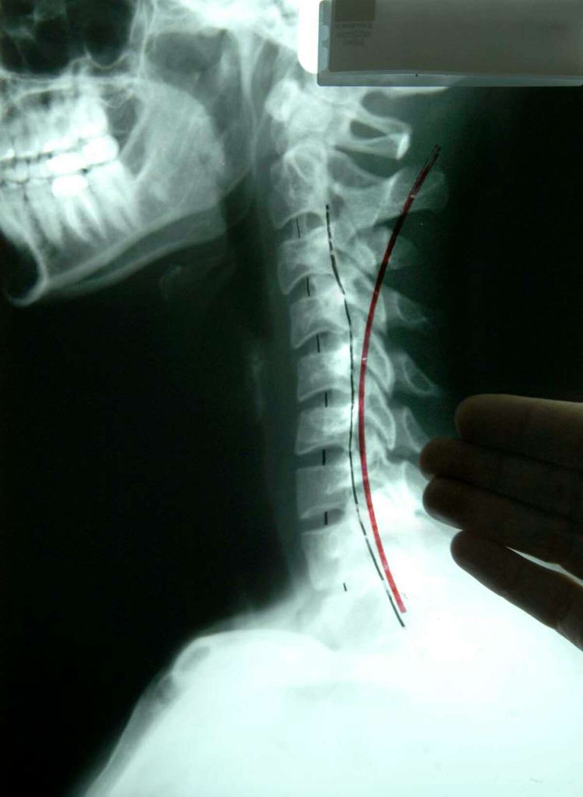 Proper posture has long-reaching effects