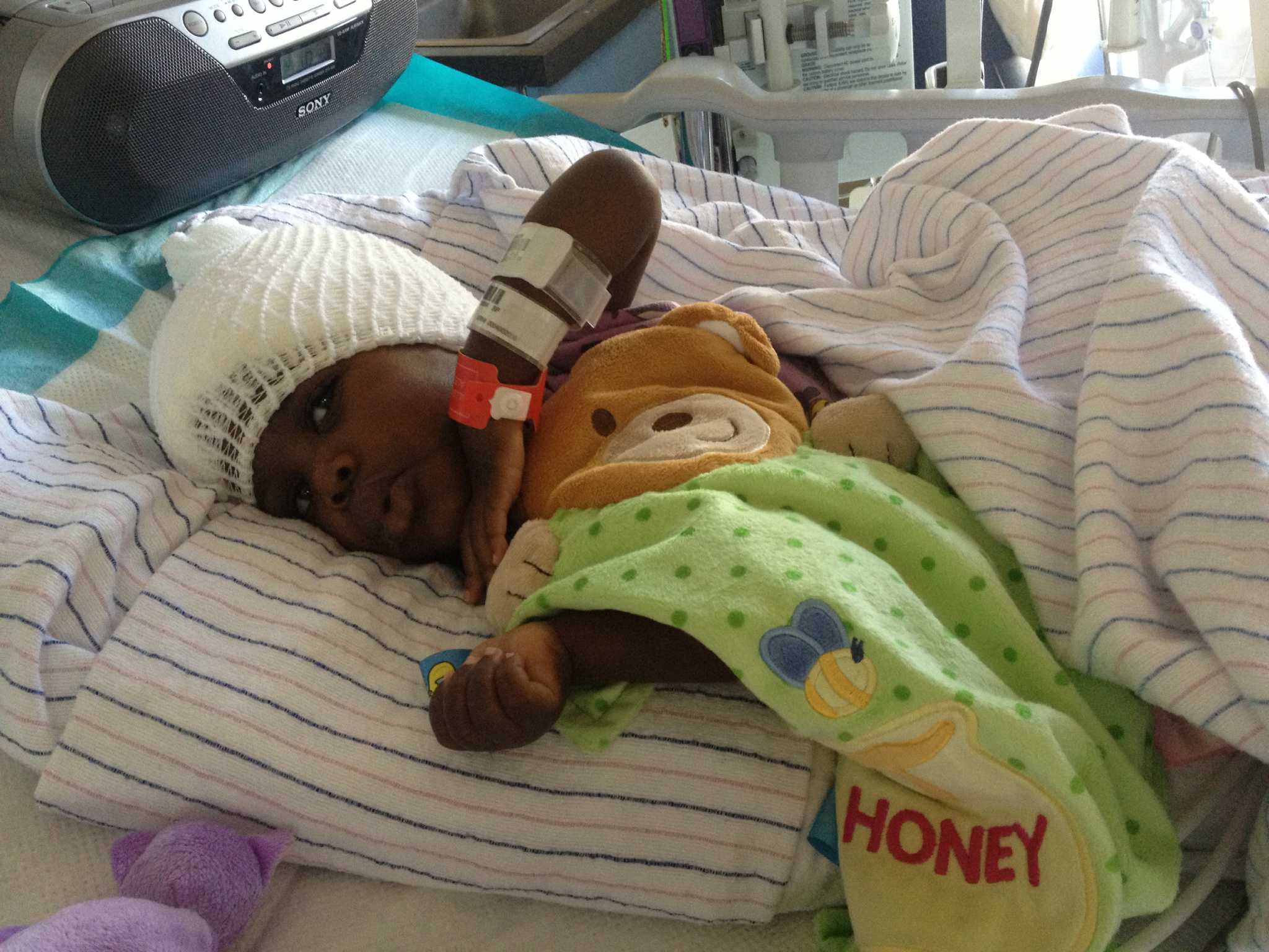 Haitian orphan, 2, gets life-saving surgery in S.A.