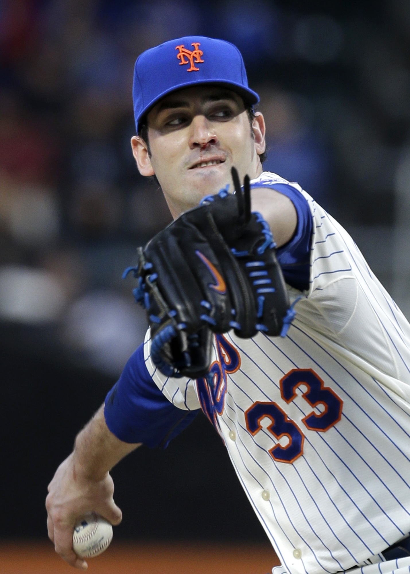 Kevin Duffy: No one expects more from Harvey than Harvey