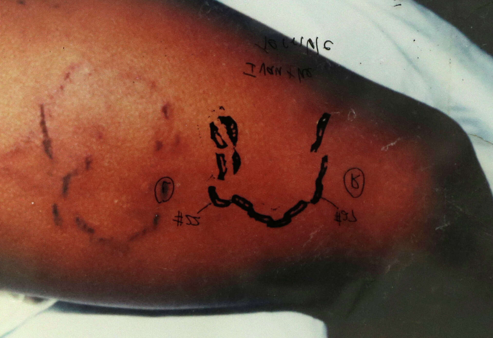 ted bundy bite mark evidence