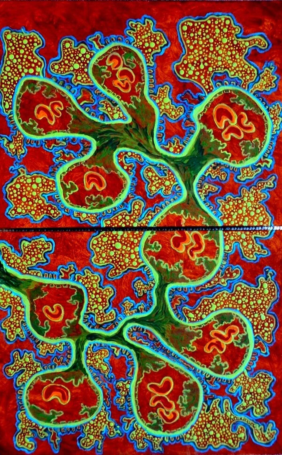 West U doc paints inner beauty of the kidney