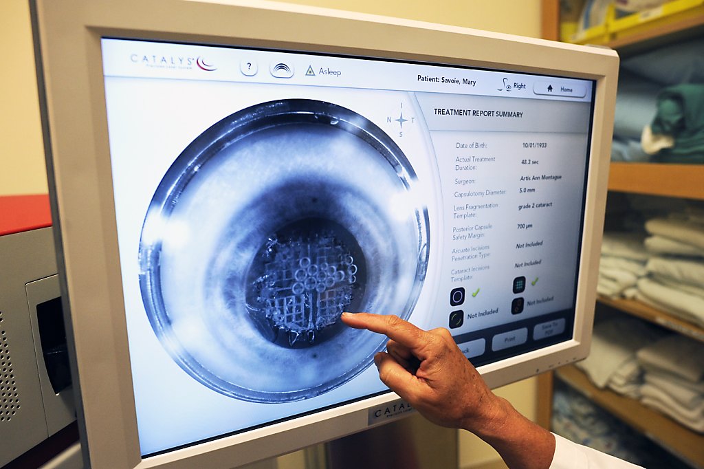 Stanford starts doing laser cataract surgery