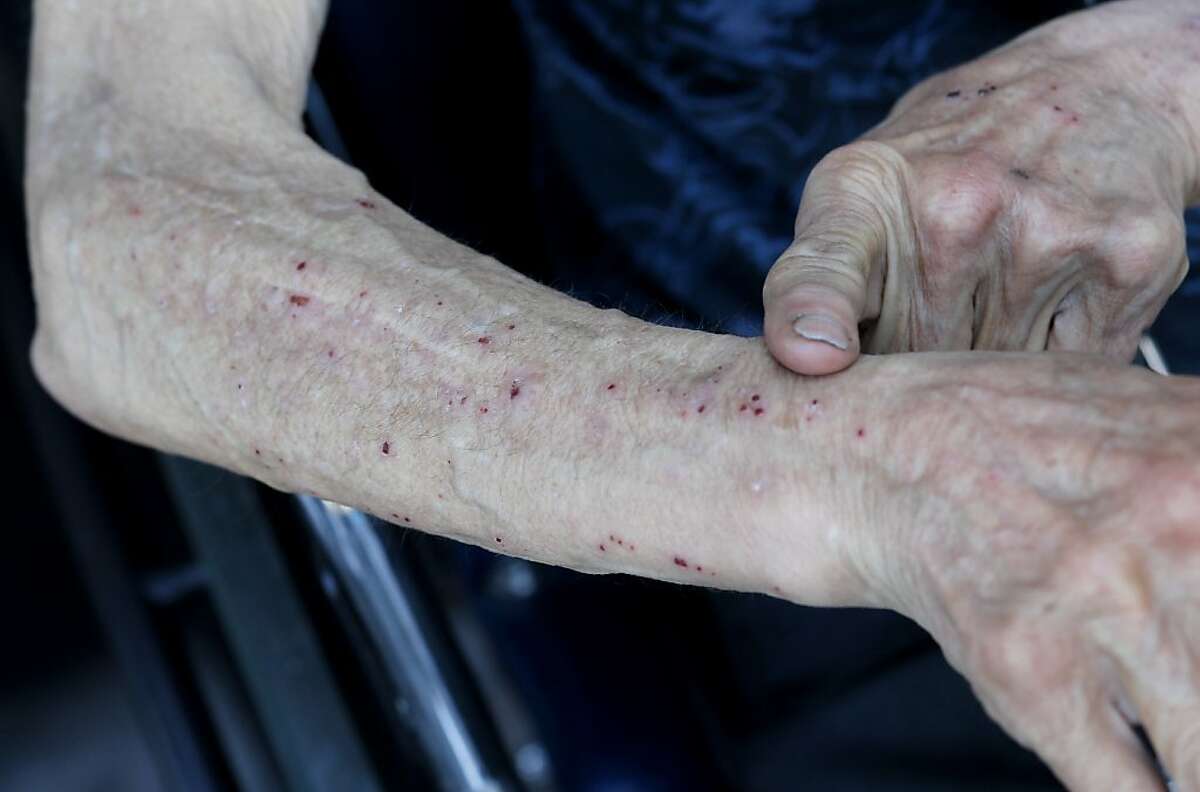 SF struggles to help ex-homeless thrive off streets