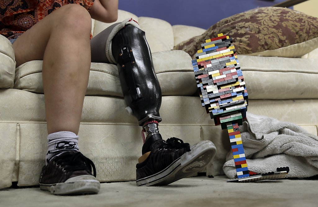 Amputee's 'Lego leg' an inspiring Internet hit