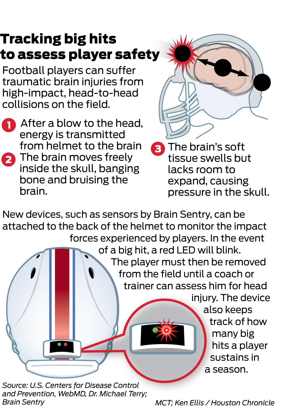 Football safety devices may let clearer heads prevail