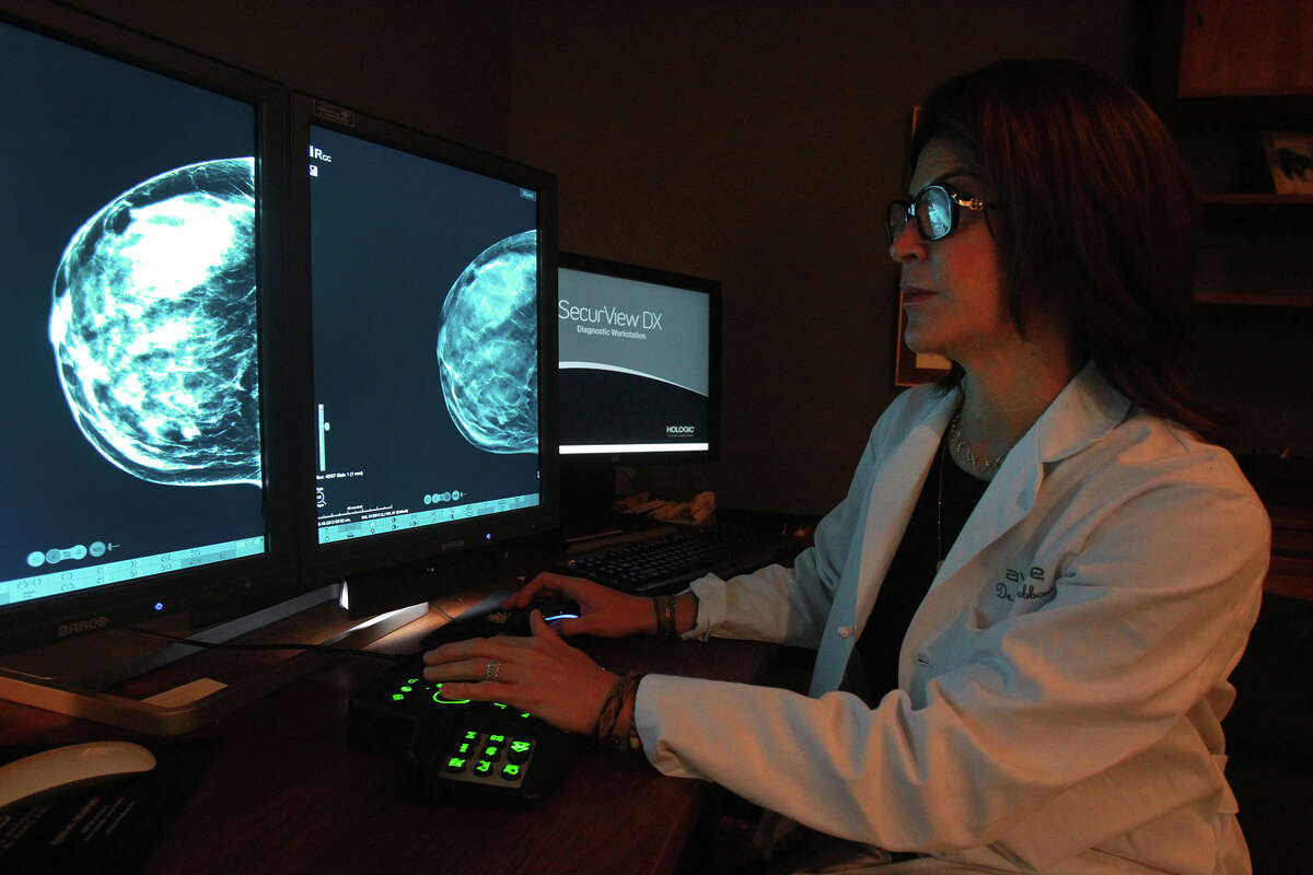 Mammograms go 3-D