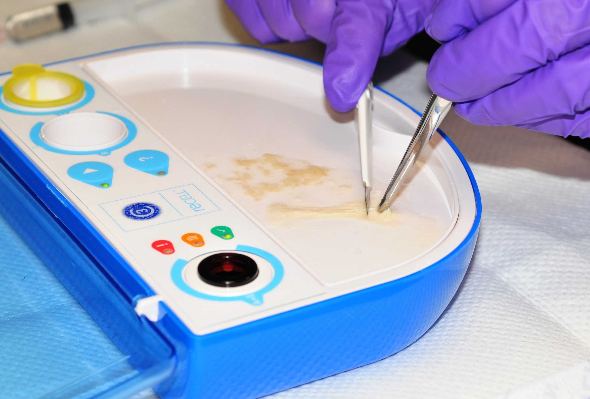 Collaboration key to burn care innovation