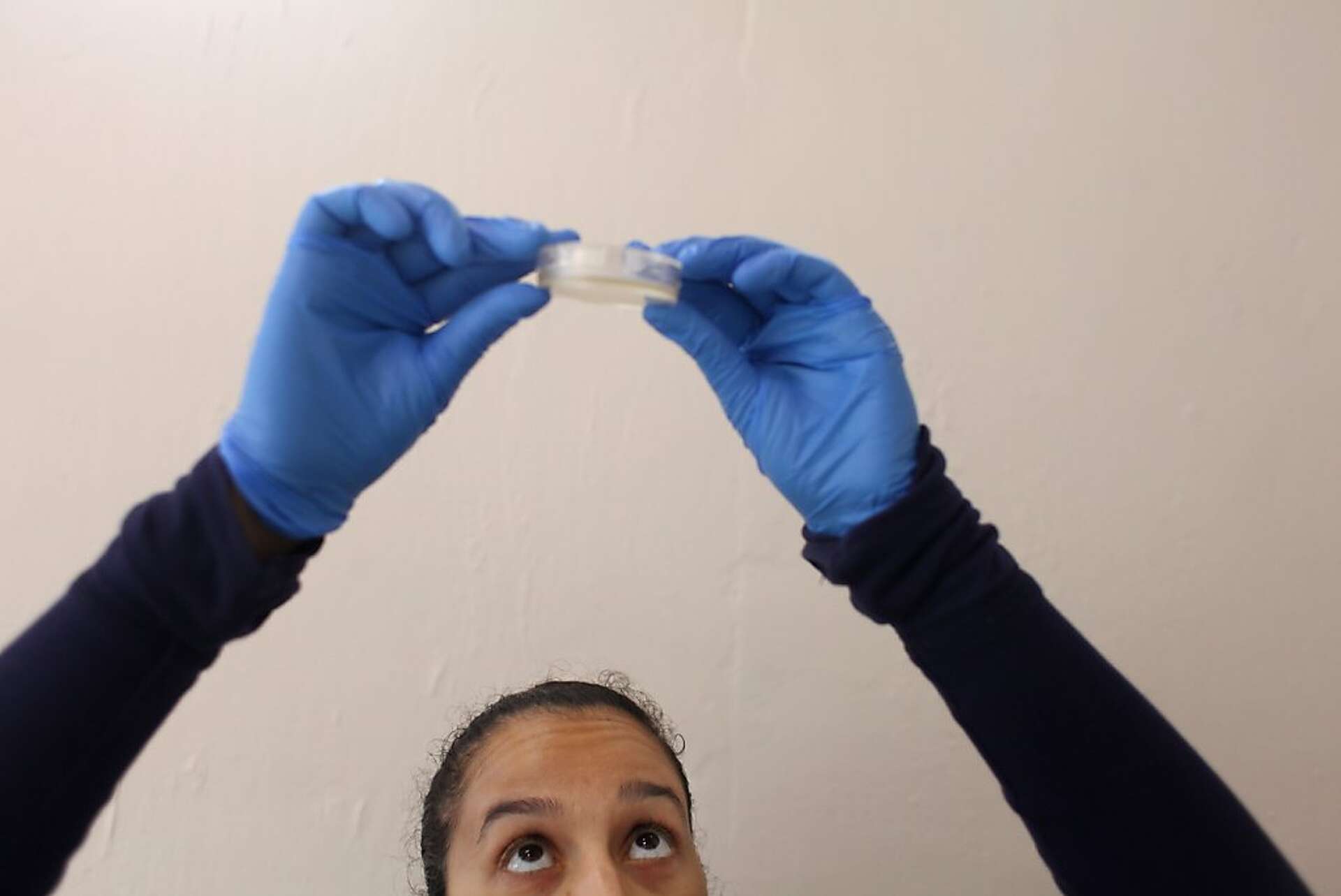 Restoring life to S.F.'s long-blighted Mountain Lake