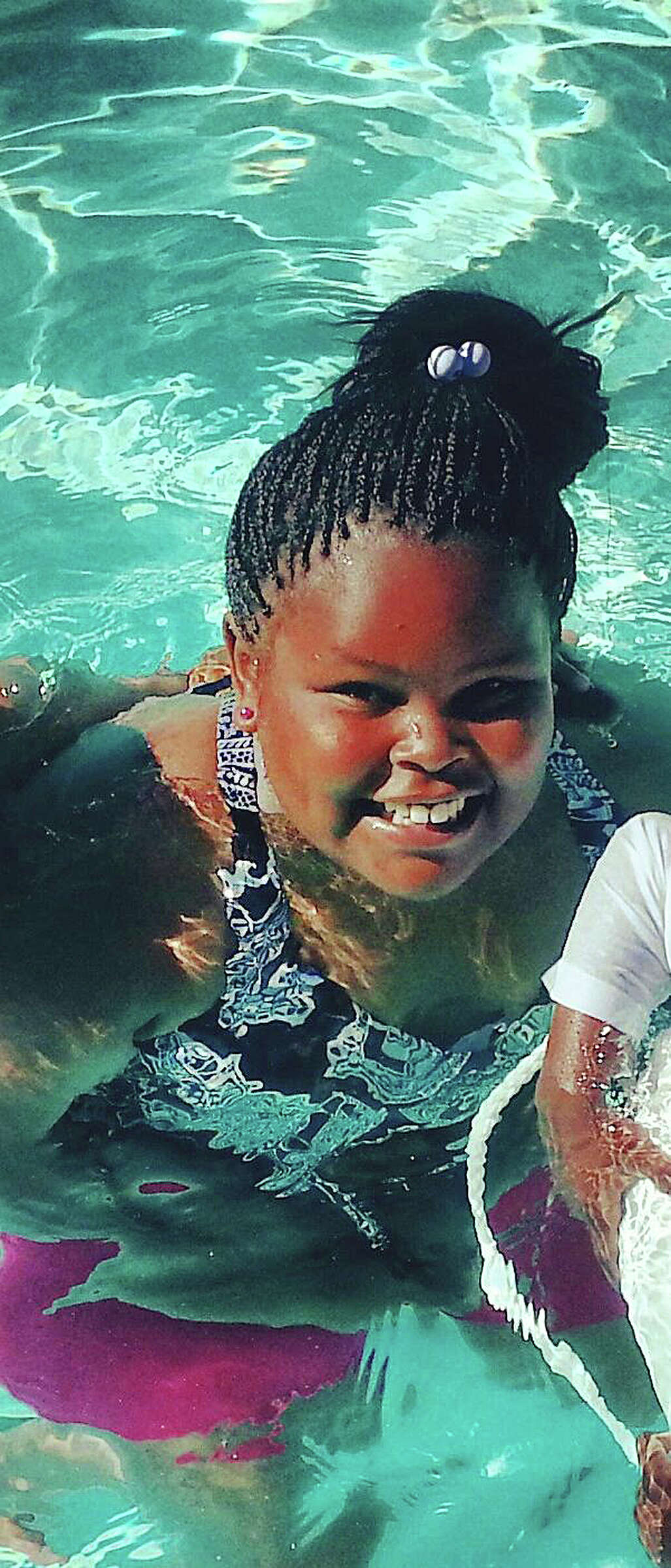 Family says brain-dead Jahi McMath showing signs of life