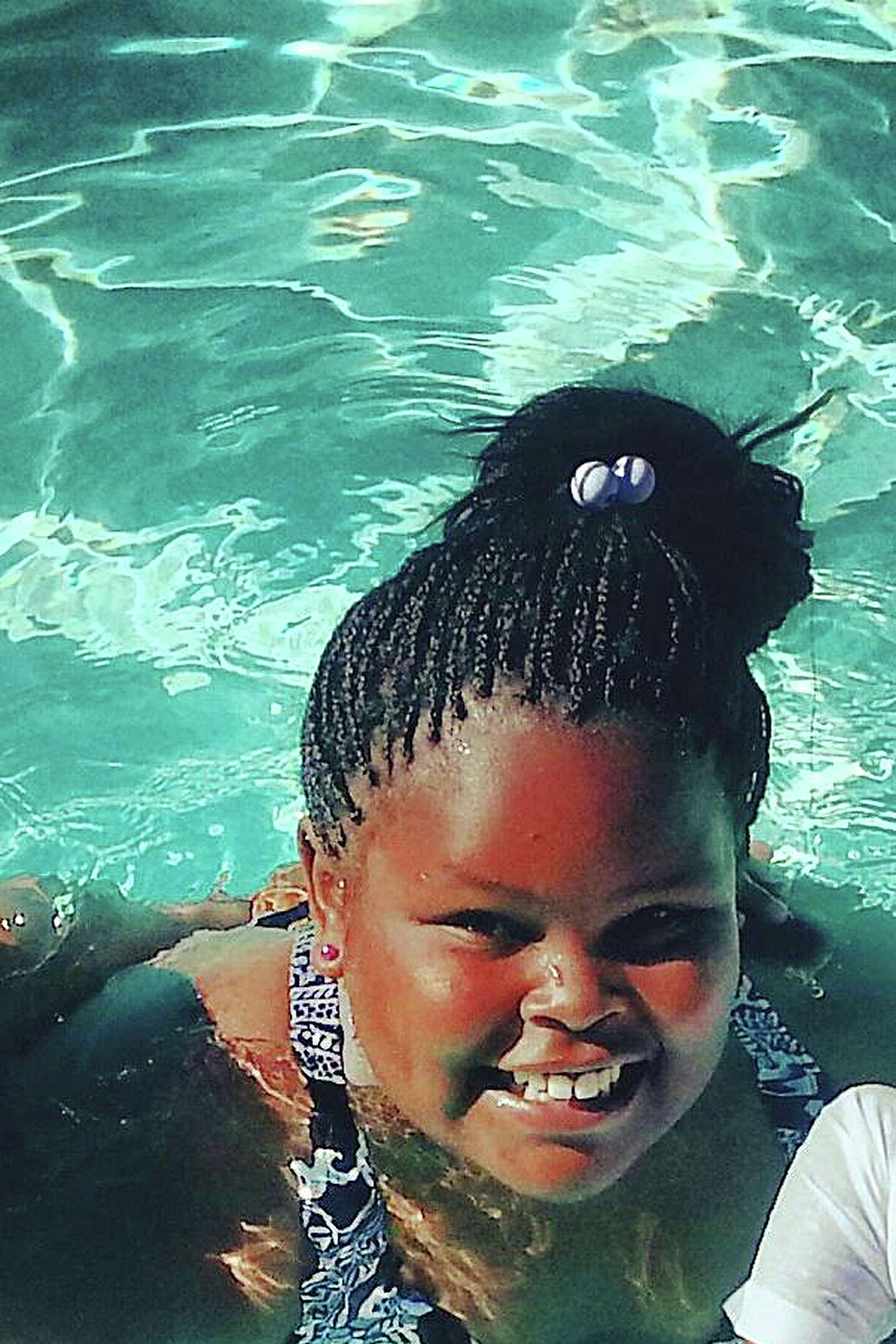 Family says brain-dead Jahi McMath showing signs of life