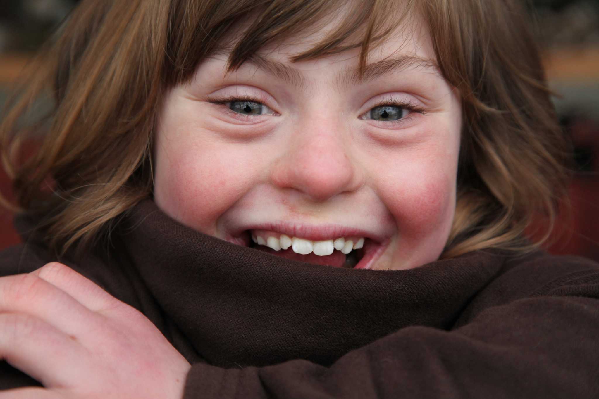 Photographer brings to life the beauty of children with genetic differences