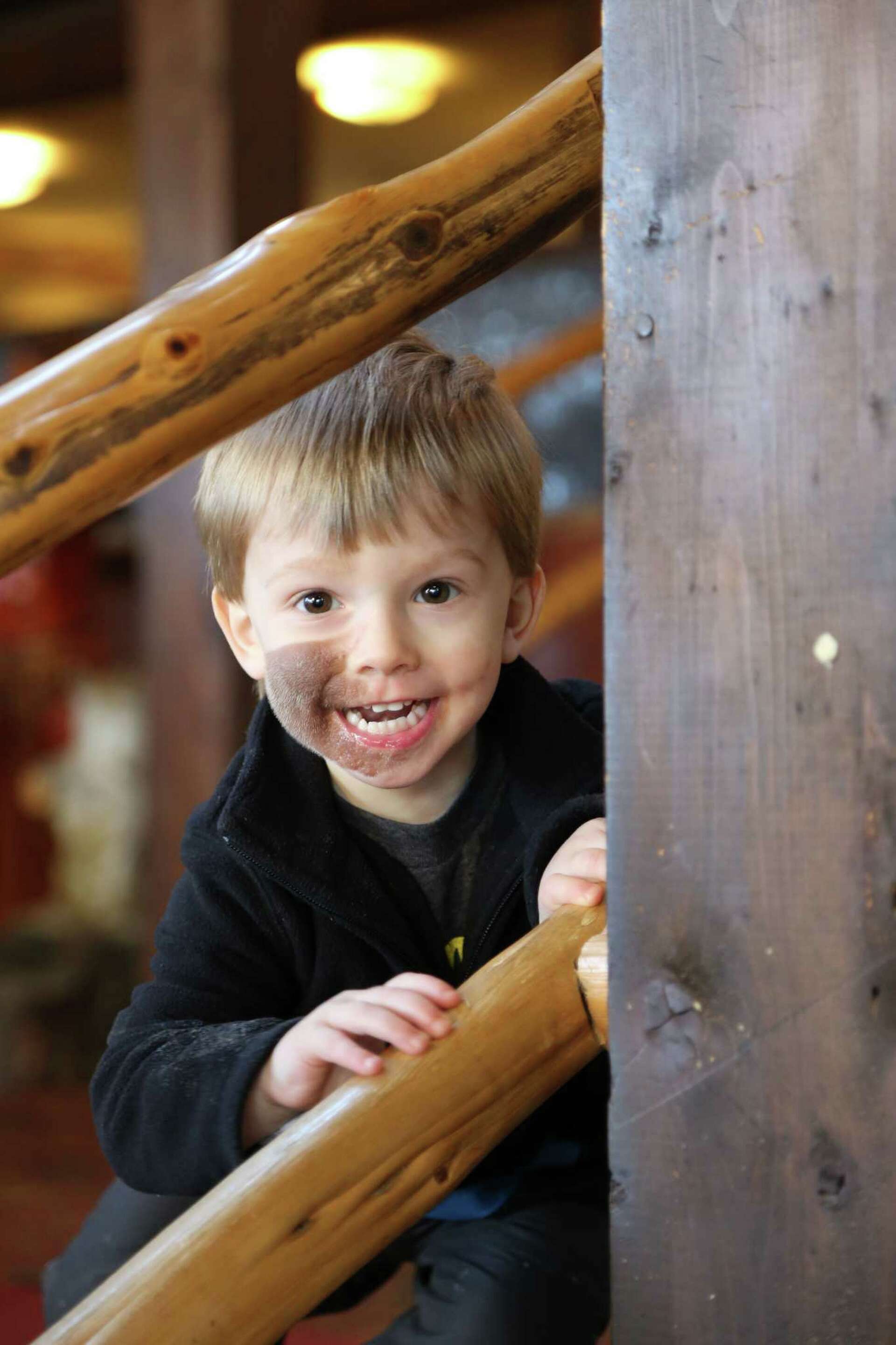 Photographer brings to life the beauty of children with genetic differences