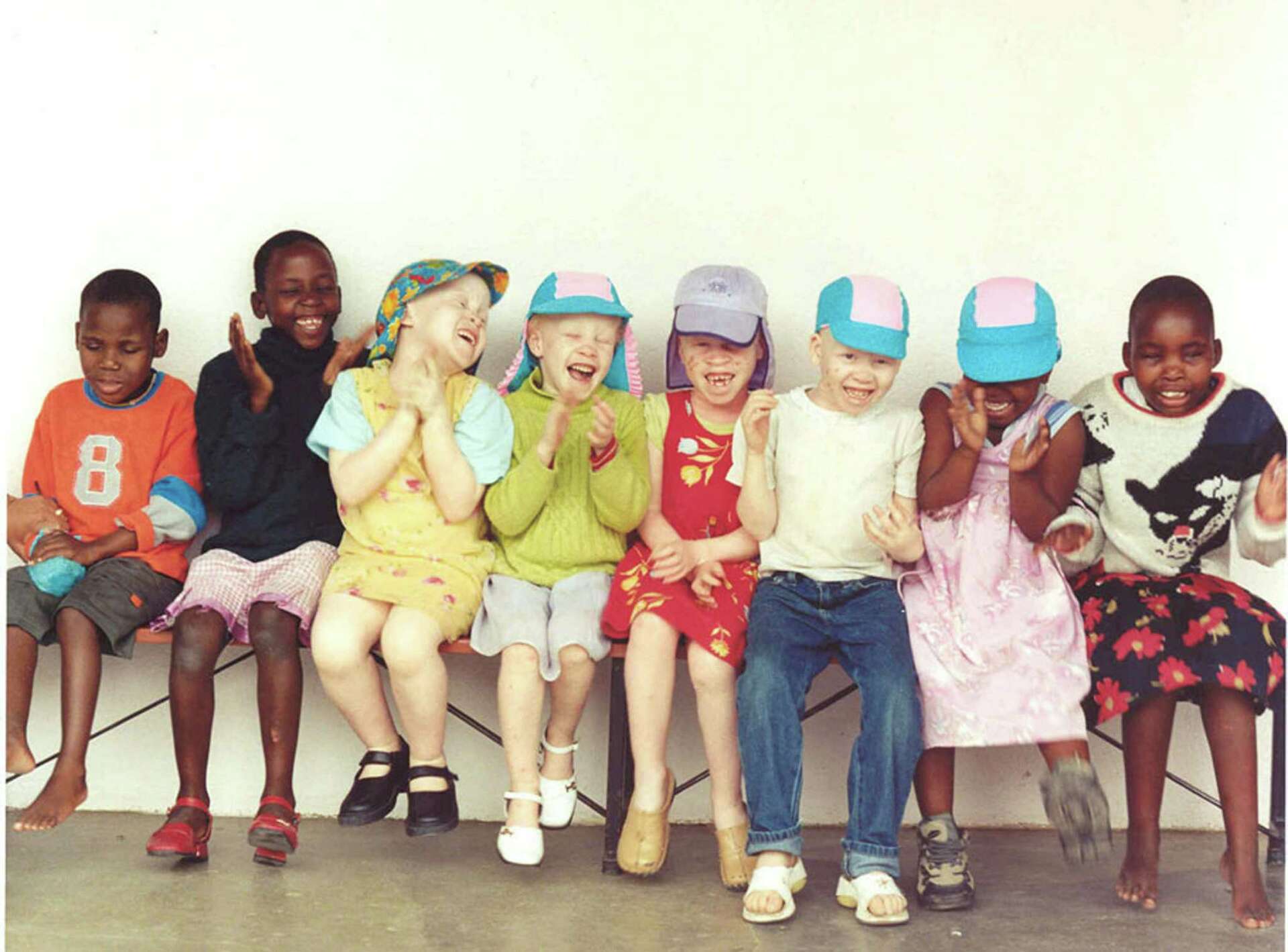 Photographer brings to life the beauty of children with genetic differences