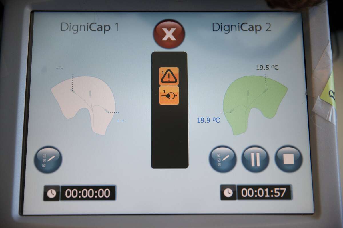 UCSF tests cold caps to reduce hair loss during chemotherapy