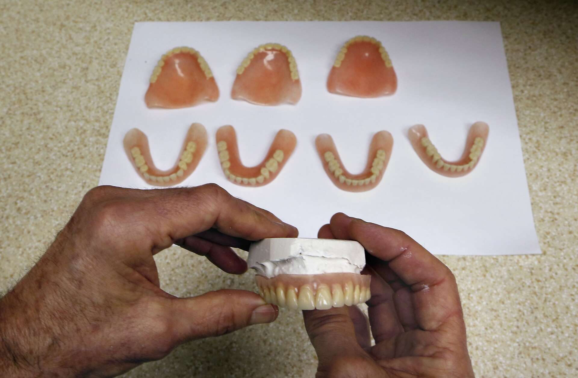 One Step Dentures: New material takes bite out of cost
