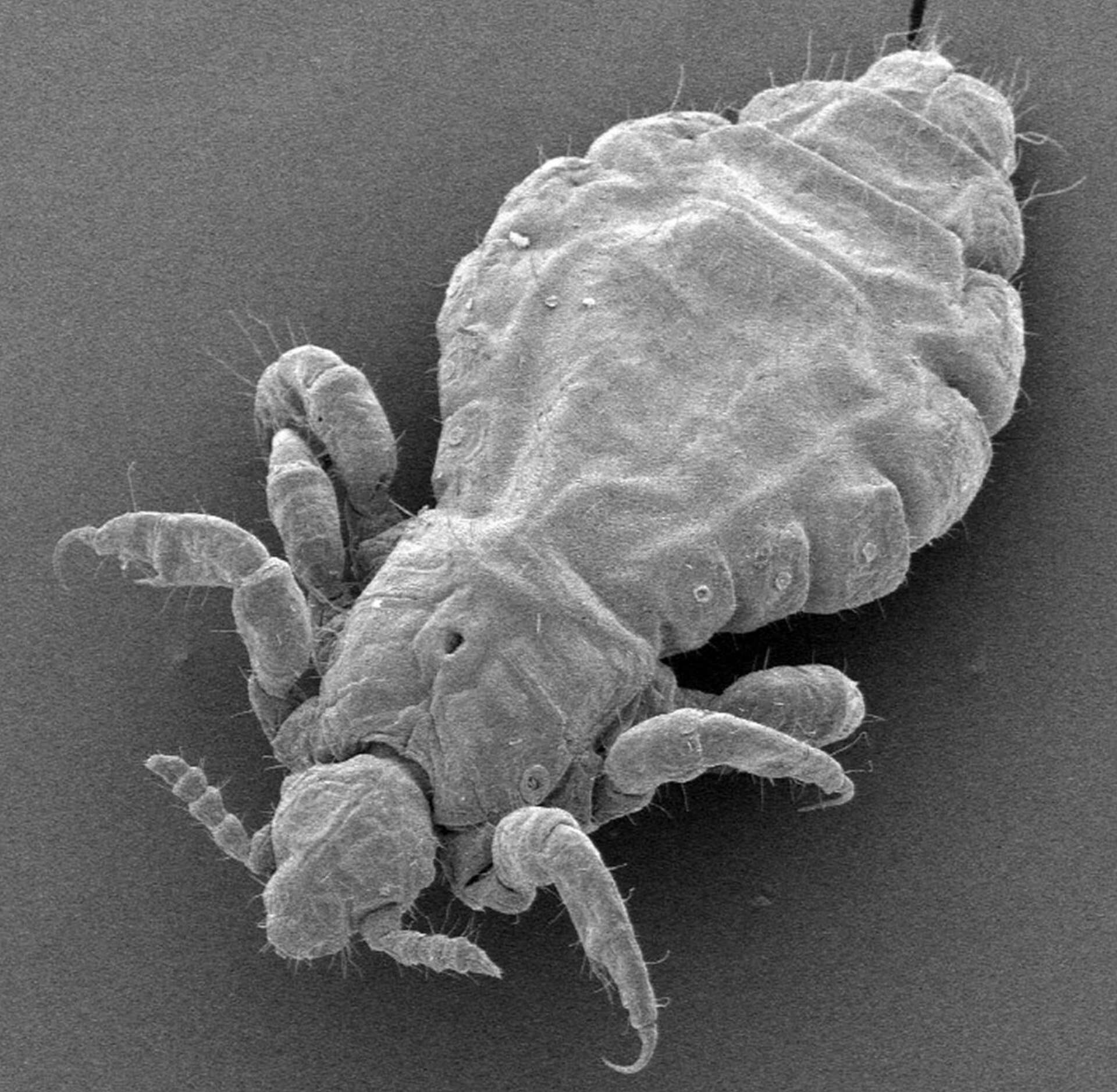Head Louse Microscope Download Louse Under Microscope Wallpaper