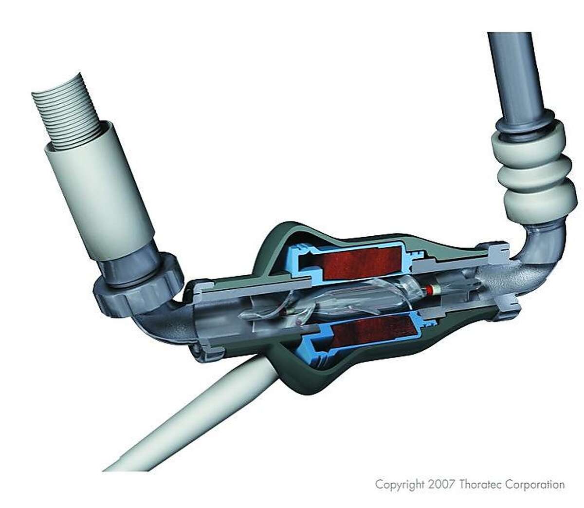 Thoratec warns of heart pump's link to 4 patient deaths
