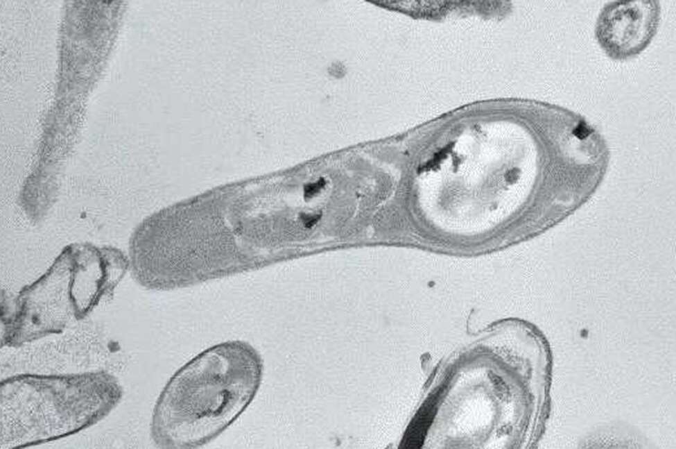 Things to know about vibrio vulnificus, a bacteria that occurs ...