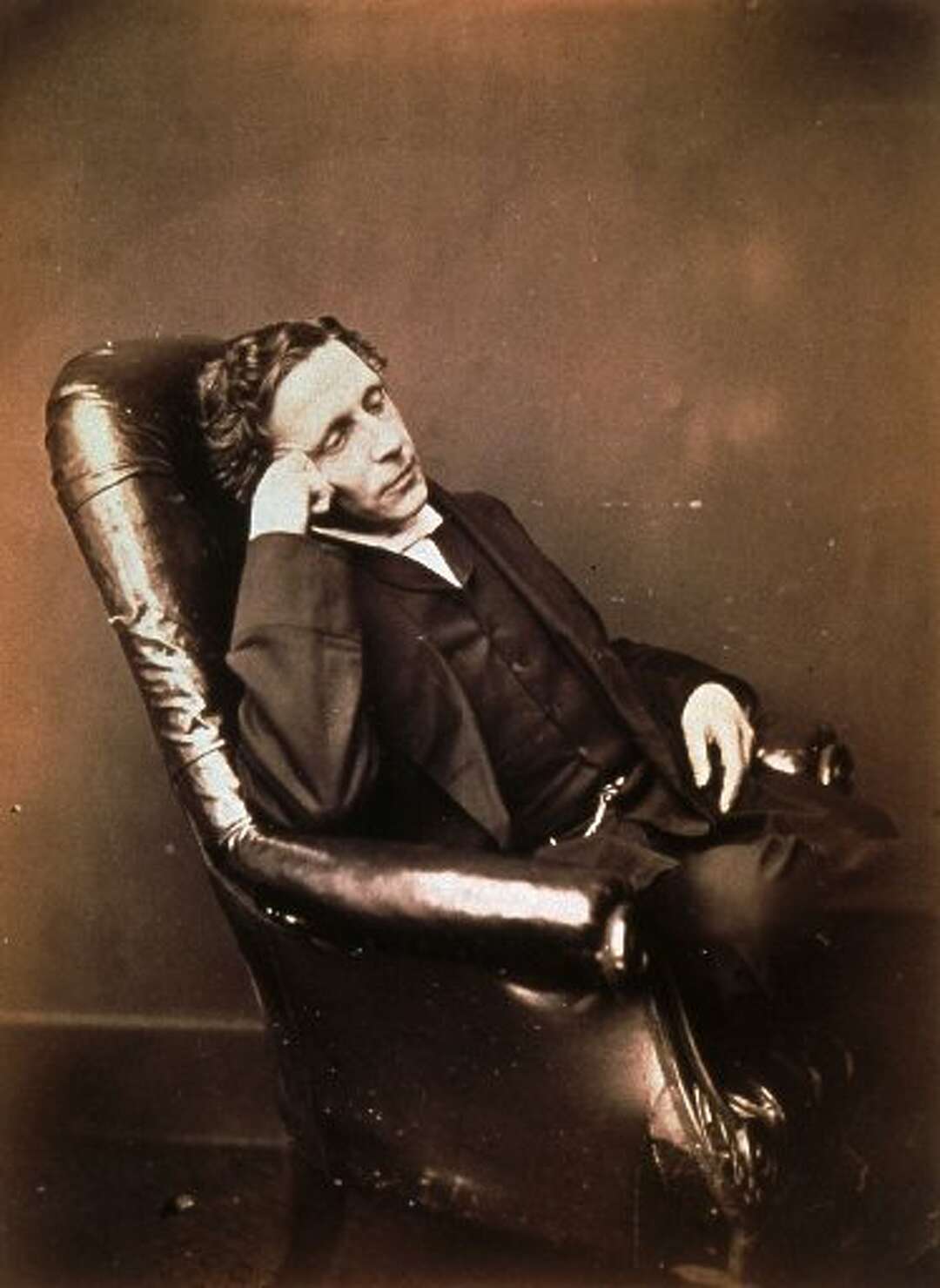 14 famous people who overcame stutters