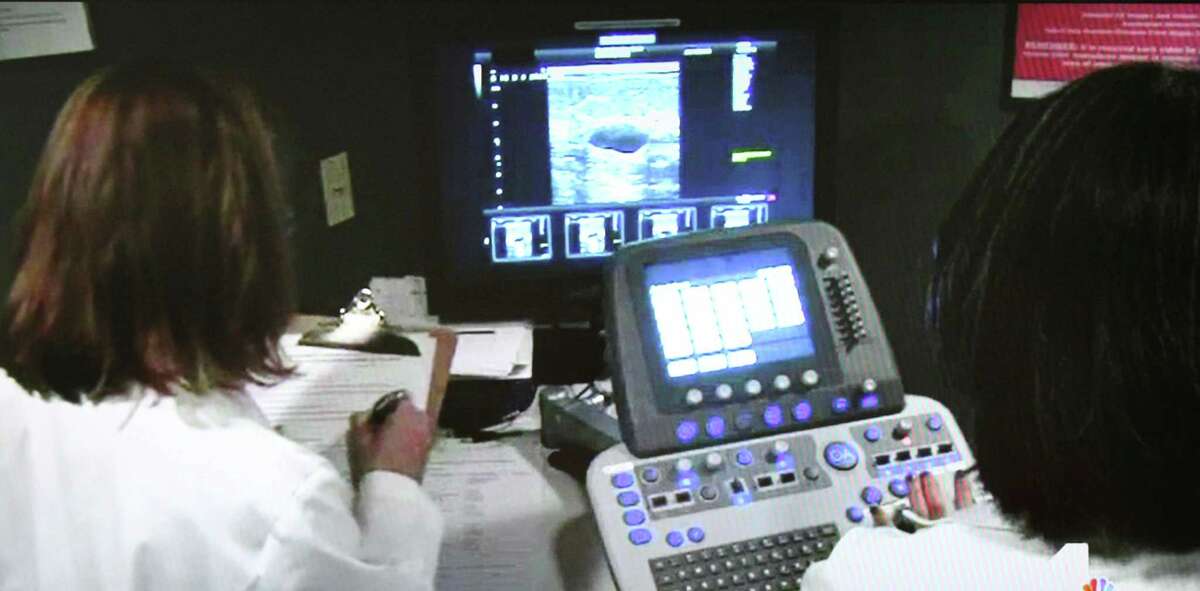 Seno making strides with cancer-detection technology