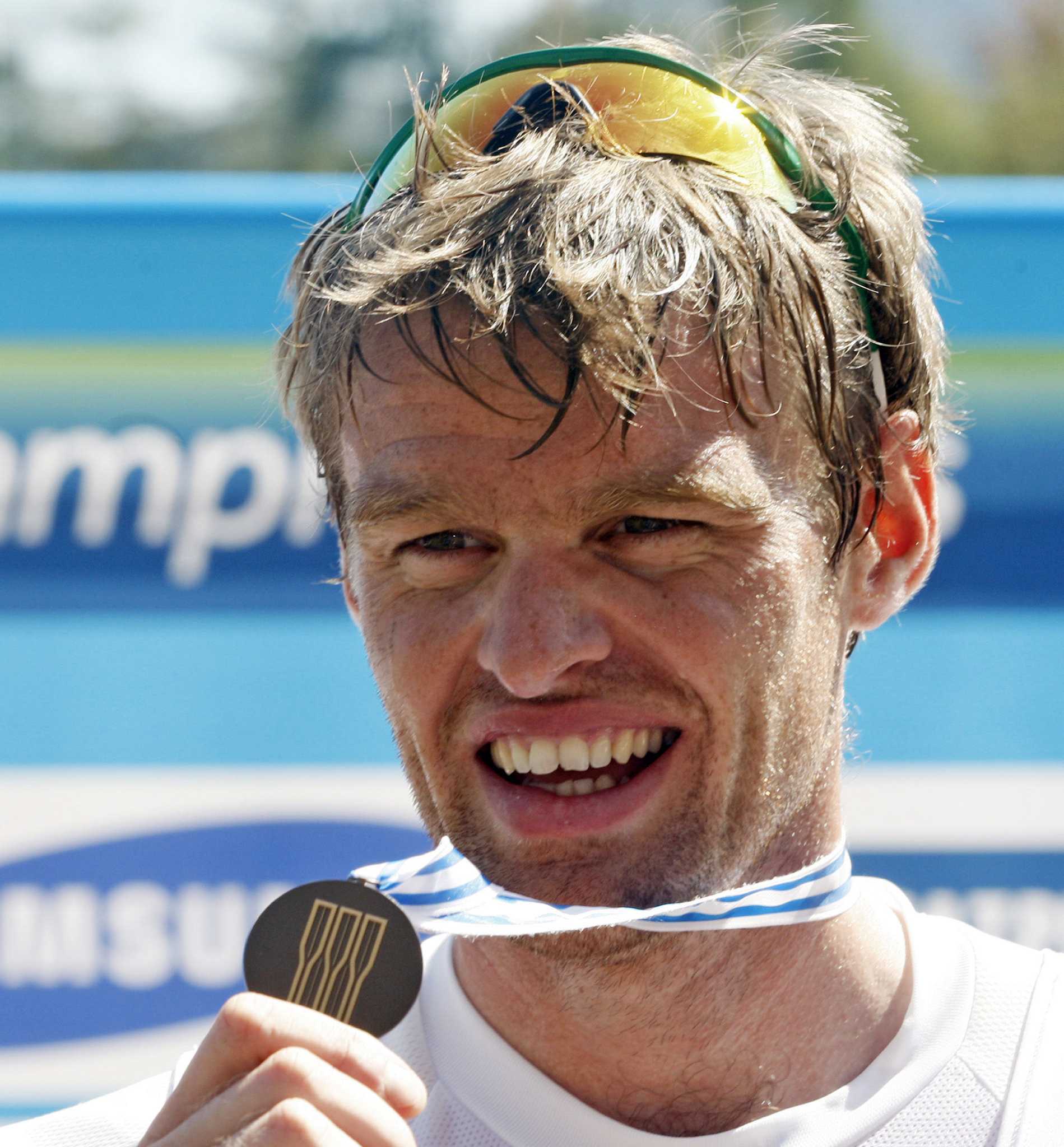 Elite athletes often have 'garbage' teeth