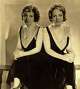 Film rich look at S.A.'s conjoined twins