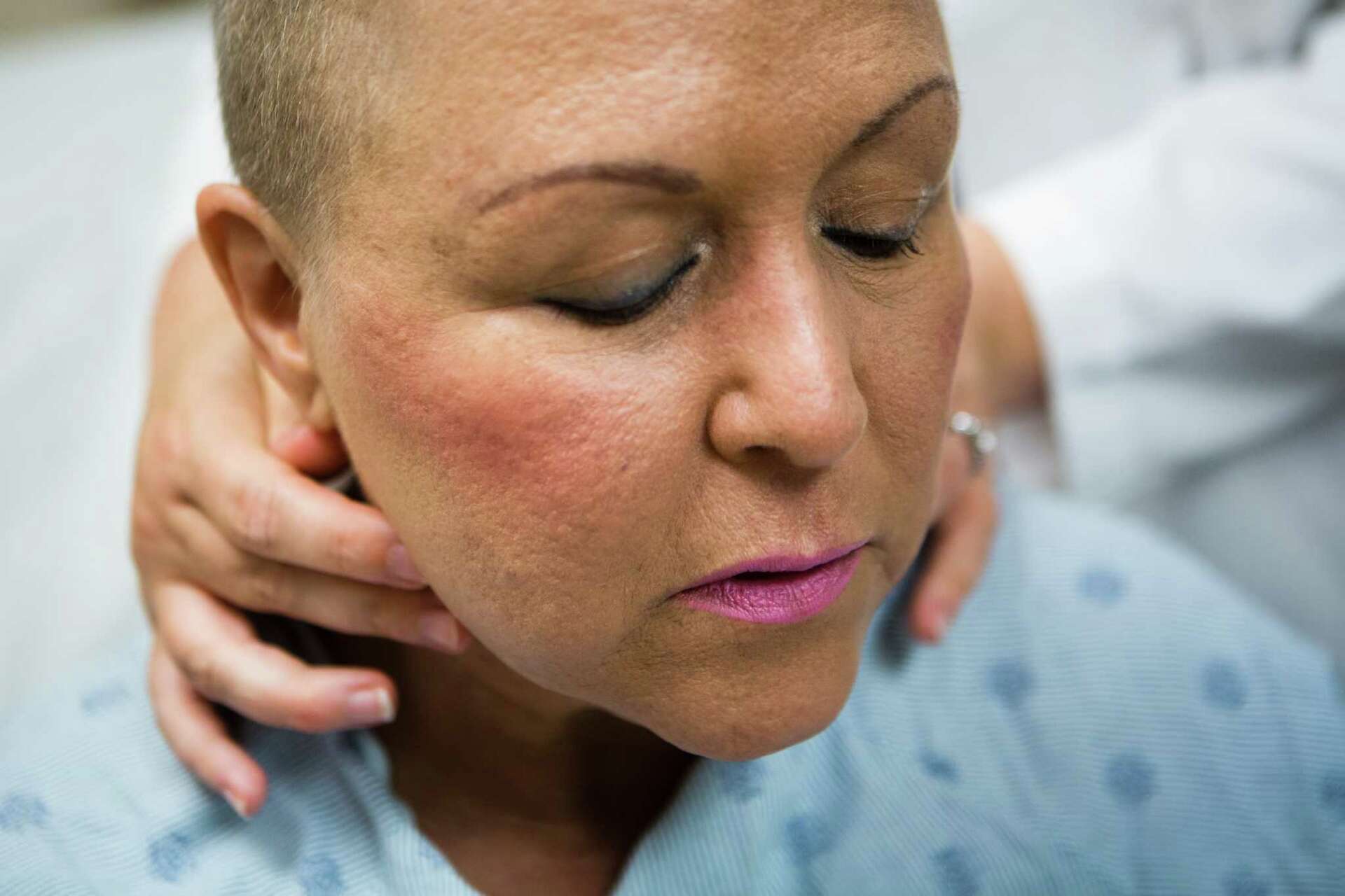 Many women not getting correct care for rare breast cancer