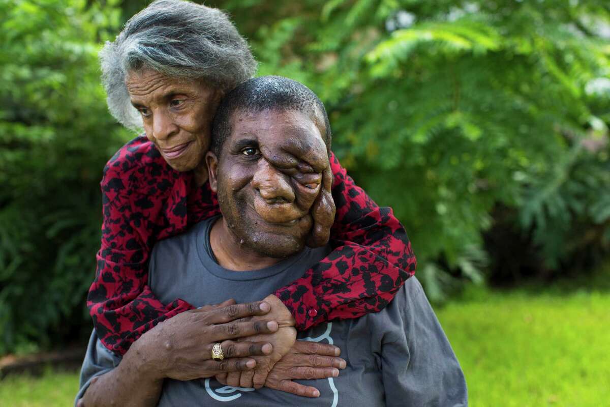 Tumors can't stop Reggie Bibbs