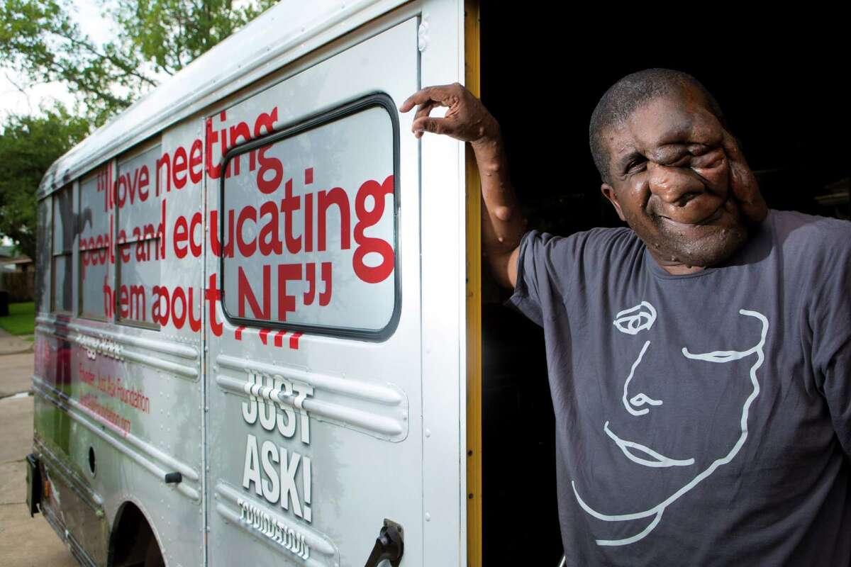 Tumors can't stop Reggie Bibbs