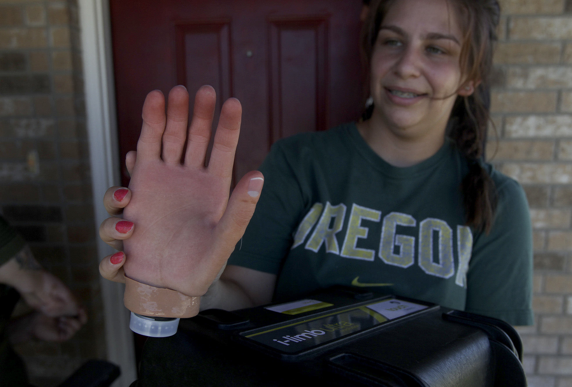 Triple-amputee theft victim to receive upgraded hand