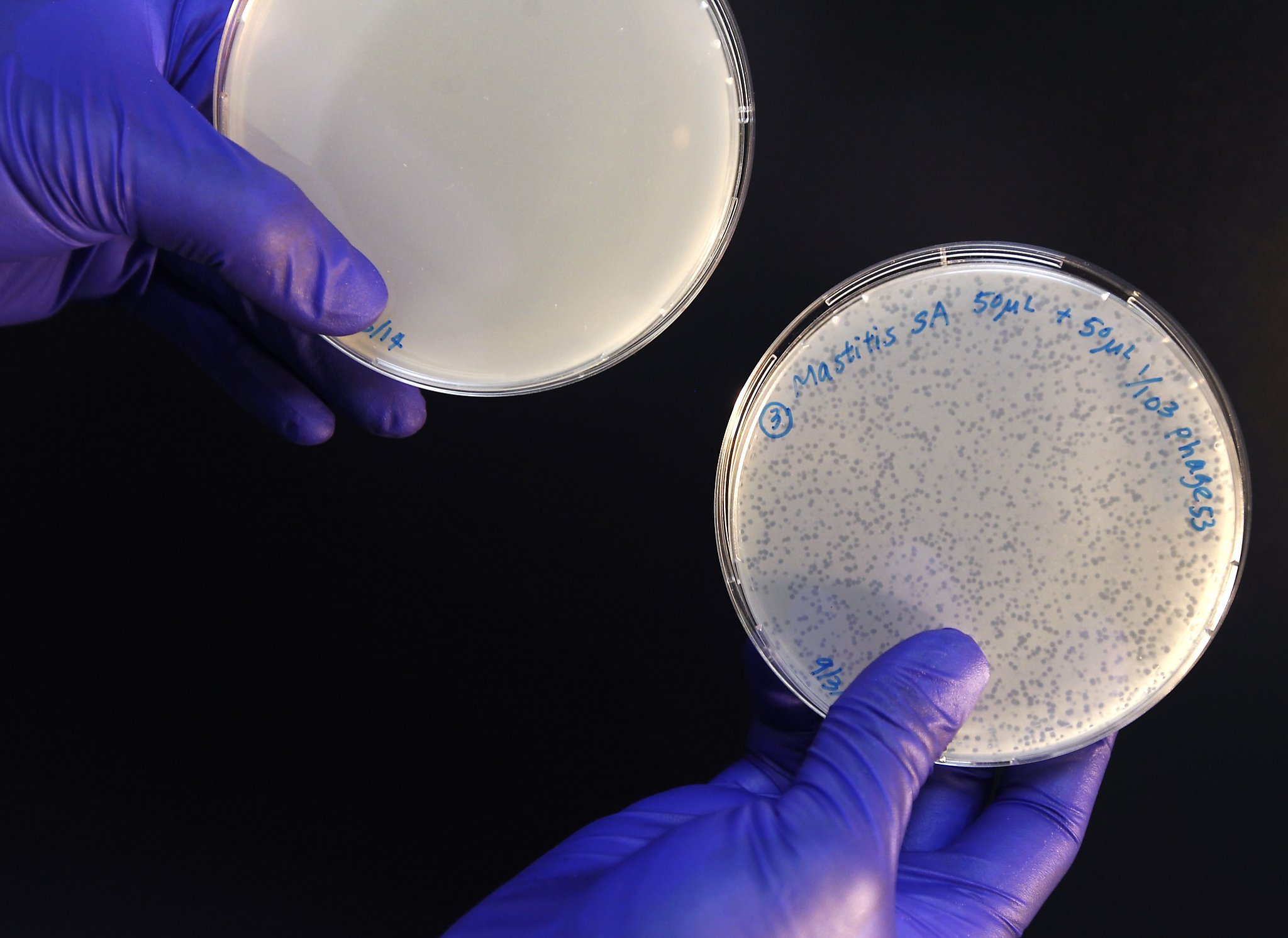 Bacteria-killing viruses seen as alternative to antibiotics
