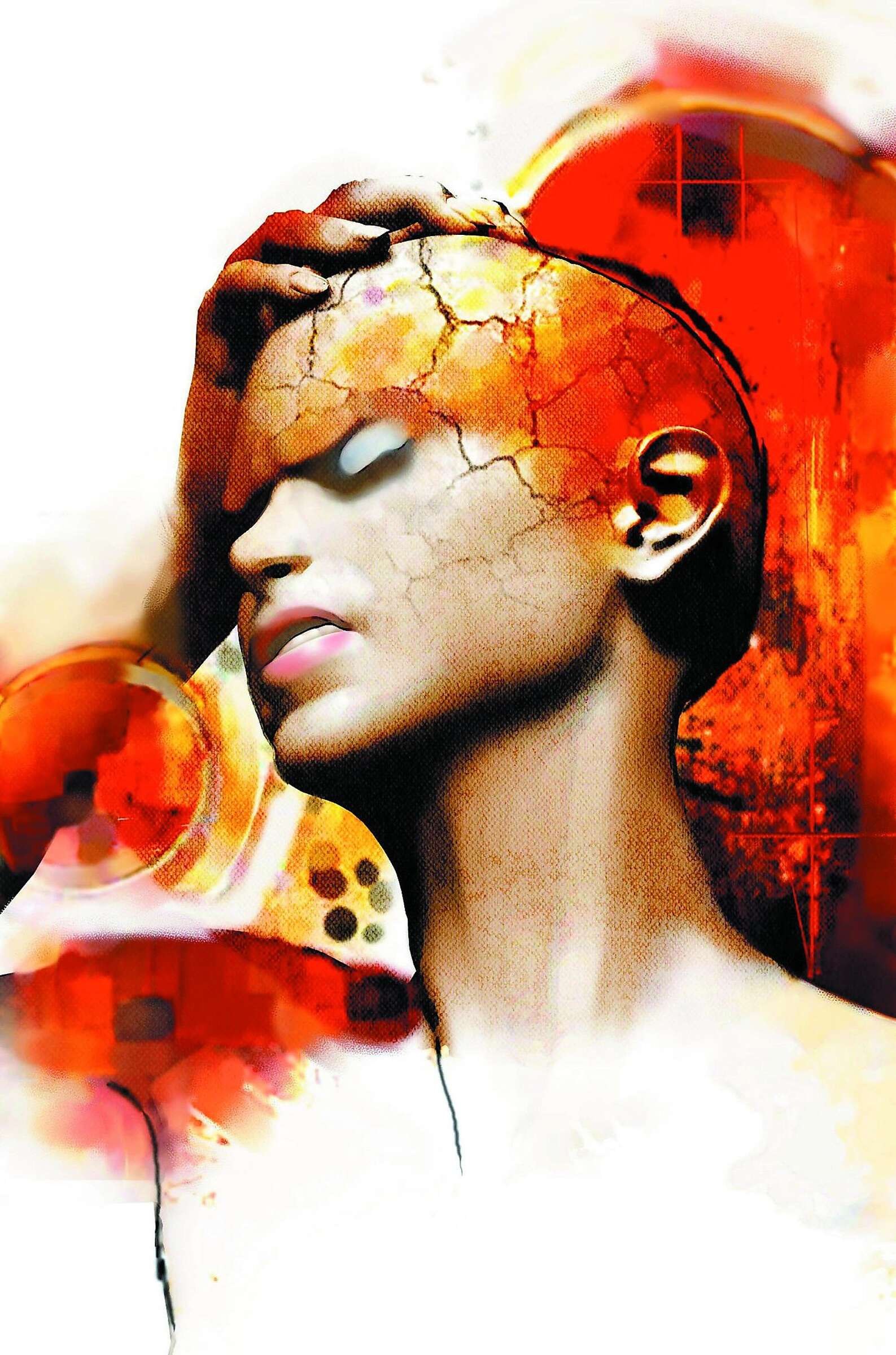 Migraine pain stopped with glaucoma medicine, doctors say