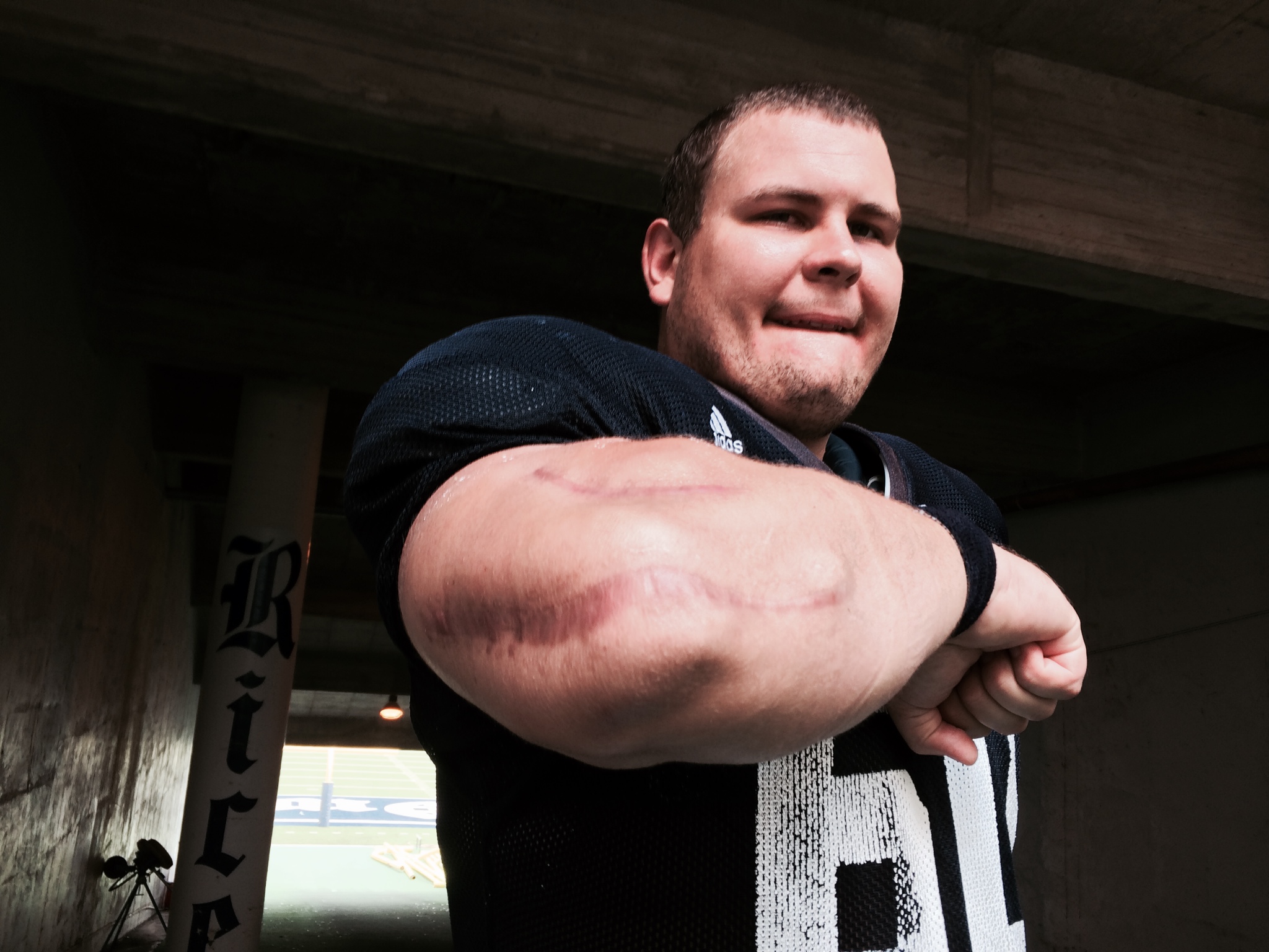 Rice center returns after gruesome elbow injury