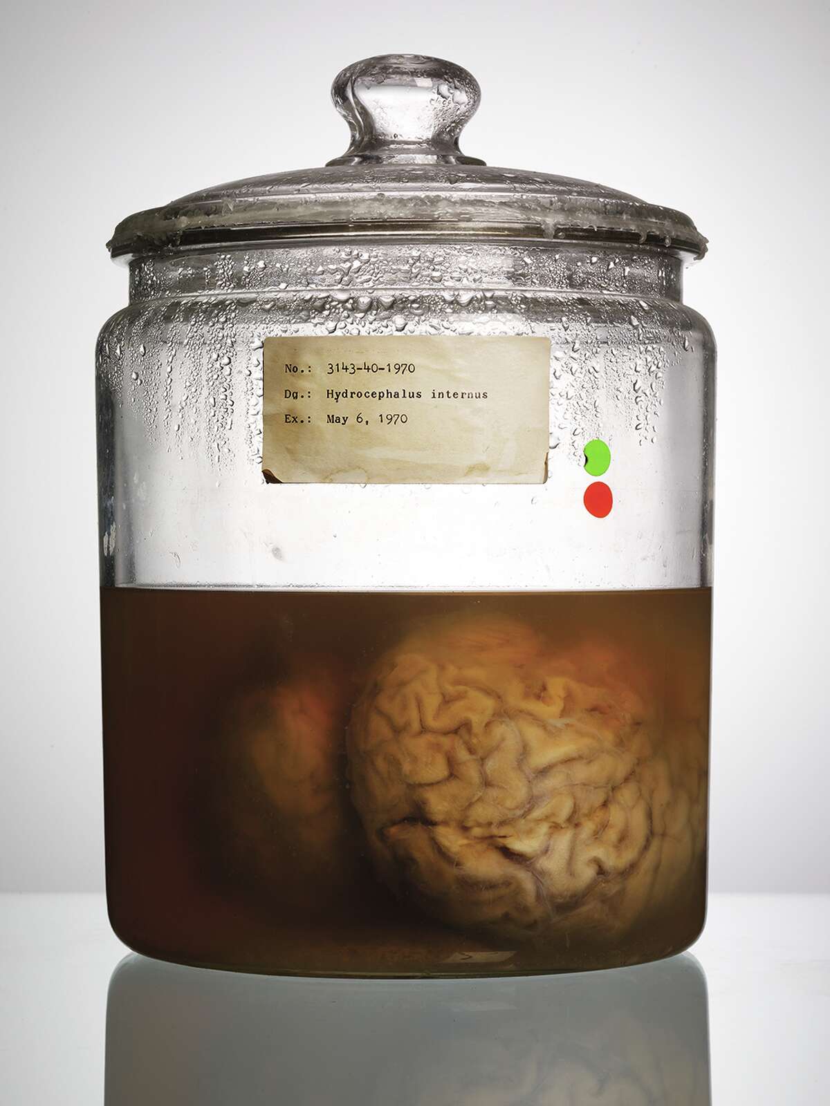 UT: Missing brains disposed of in 2002