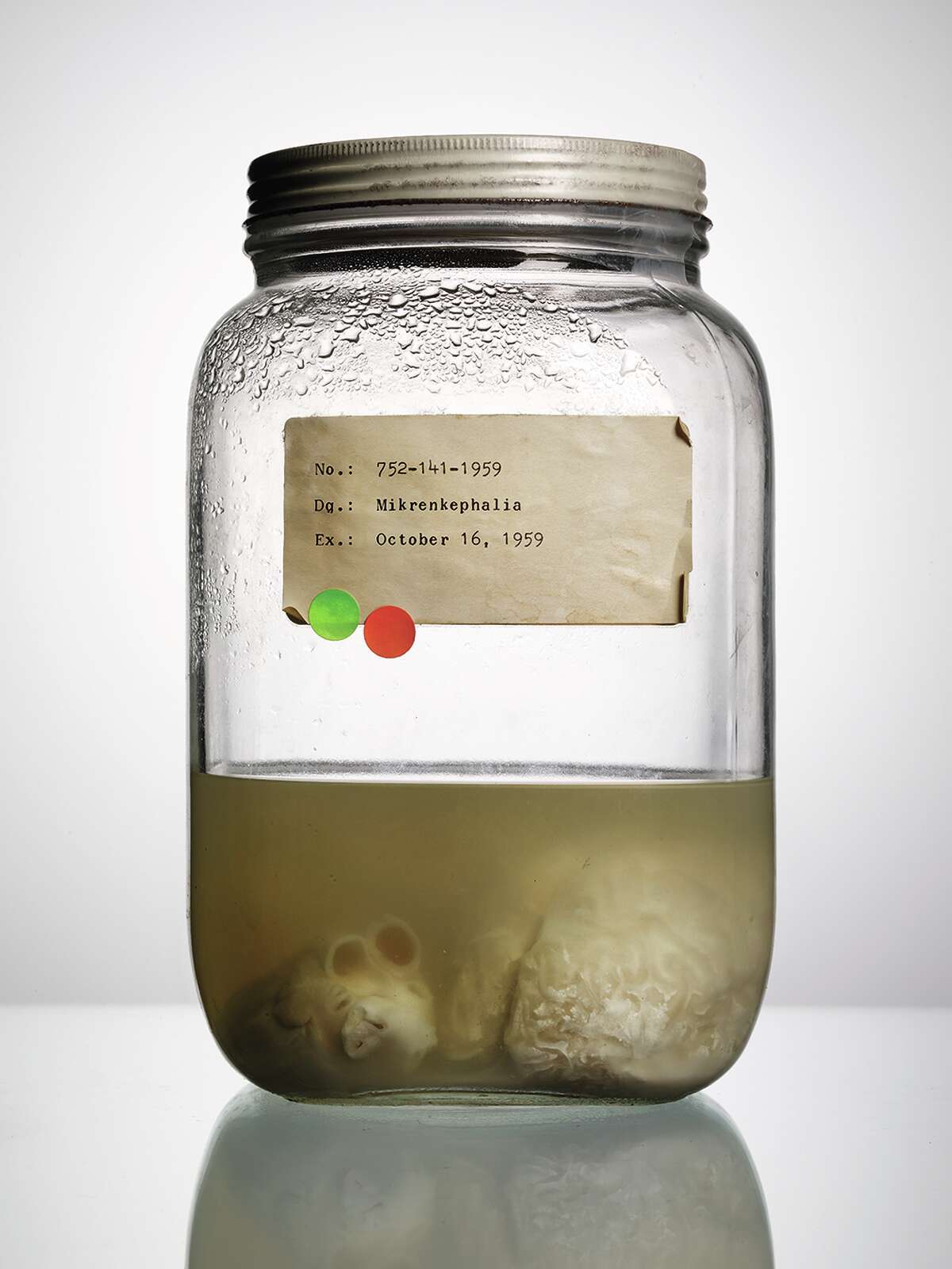 UT: Missing brains disposed of in 2002