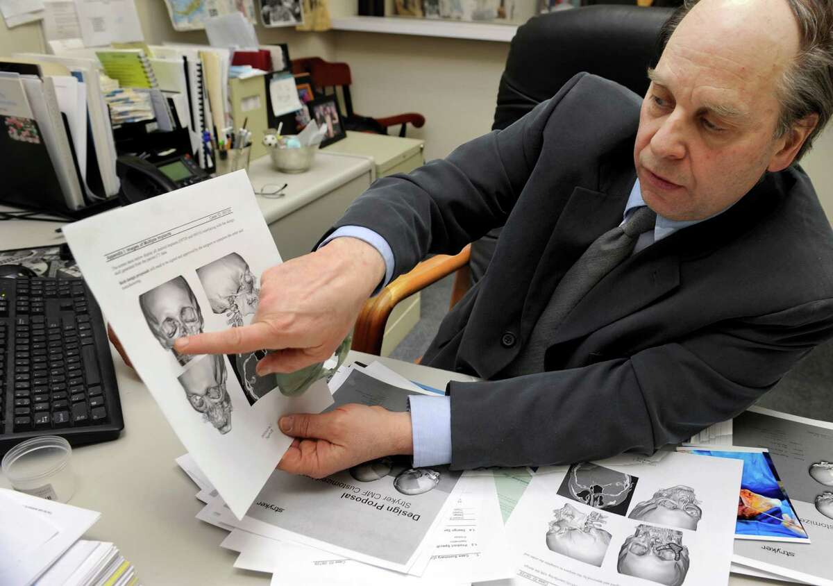 Danbury man's facial bones rebuilt with 3D-technology