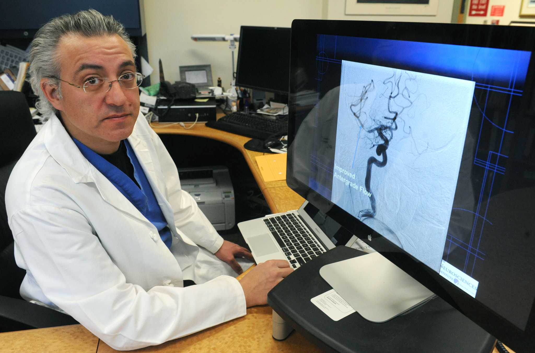 Research boosts clout of clot-removing stroke surgery